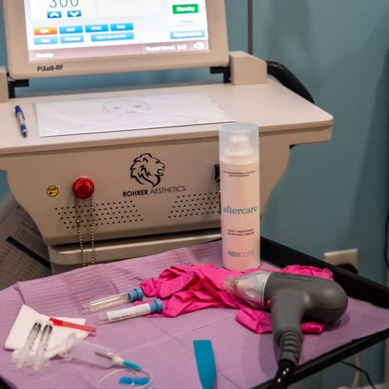 RF Microneedling in Bensalem, PA | Celestial Aesthetics